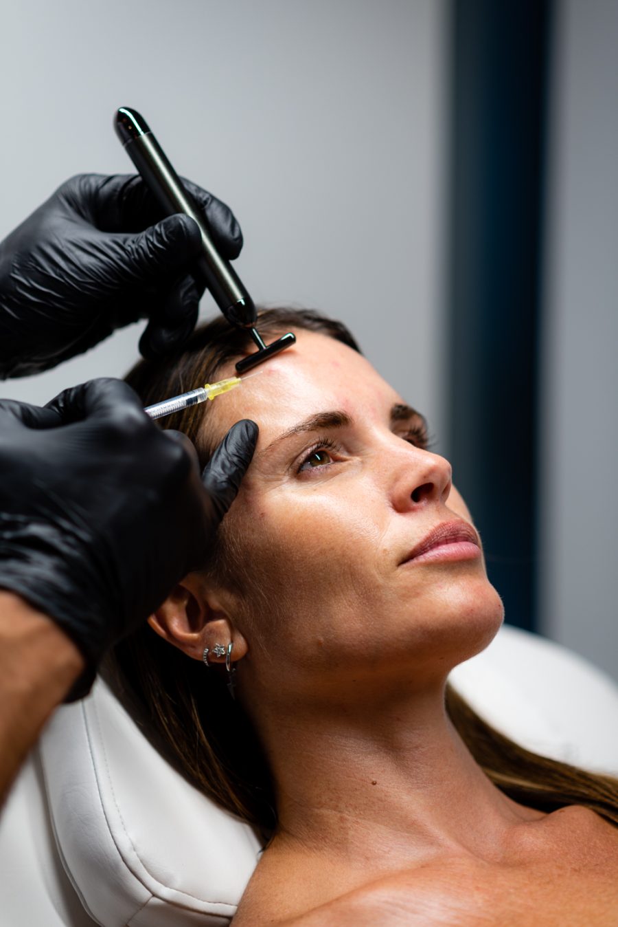 Foliculitis decalvante - Dr. Pablo Ifrán